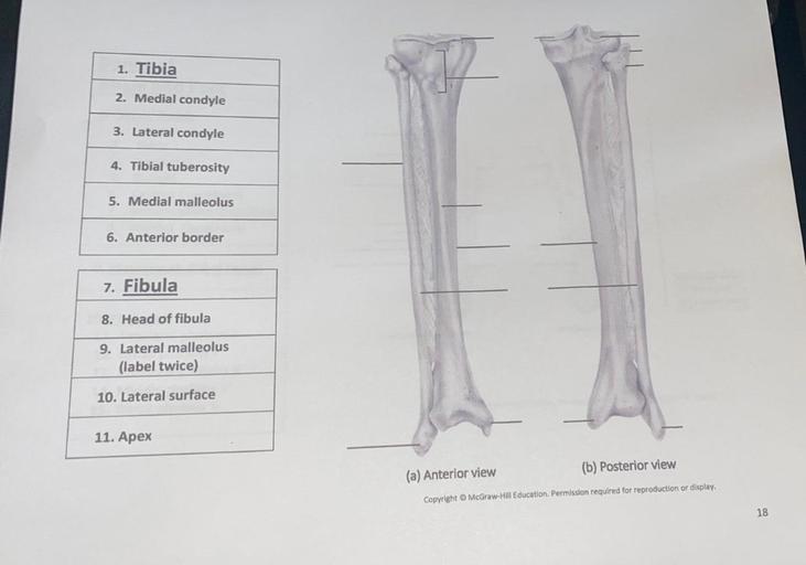 1. Tibia 2. Medial condyle 3. Lateral condyle 4. Tib... - Biology