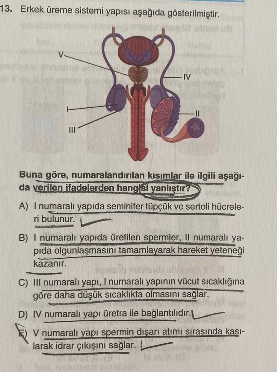 13. Erkek üreme sistemi yapısı aşağıda gösterilmişt... - Biyoloji