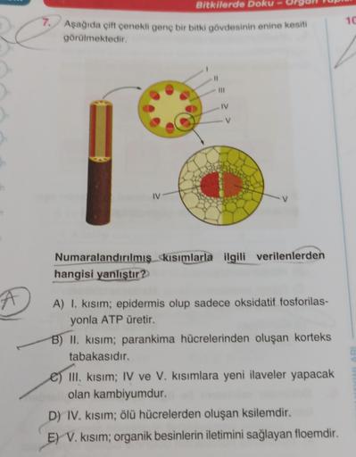 Bitkilerde Doku- 7. Aşağıda çift çenekli genç bir b... - Biyoloji