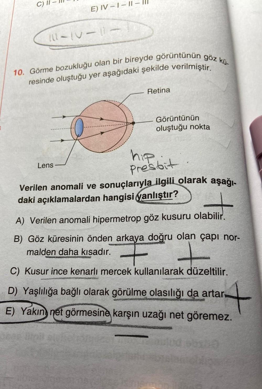 C) E) IV-1-II- 111-10-11 10. Görme bozukluğu olan bir bireyde ...