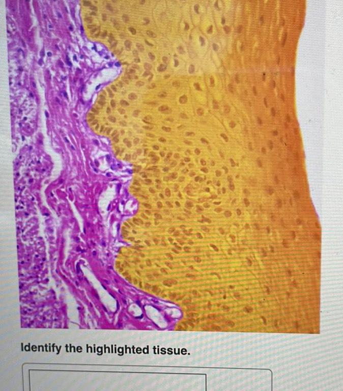 ANSWERED Identify The Highlighted Tissue Kunduz ANSWERED Identify The Highlighted Tissue Kunduz